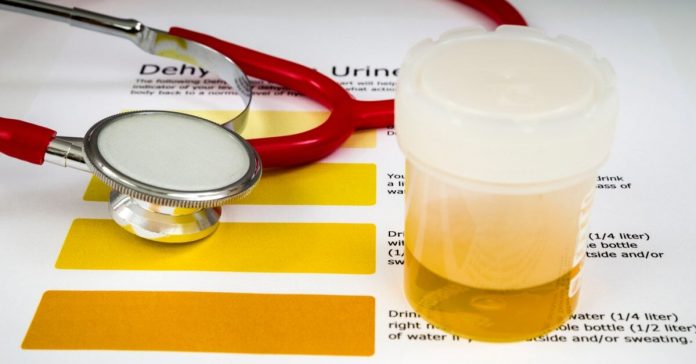 La couleur de votre urine en dit long sur votre état de santé