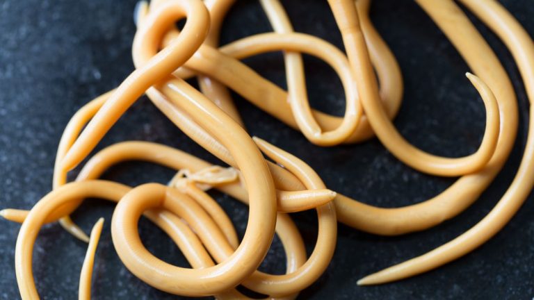 Un Américain a vécu avec un ver solitaire dans le cerveau pendant 14 ans