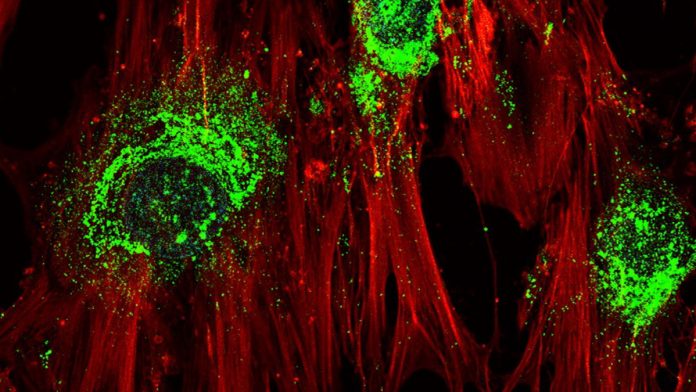 Des chercheurs transforment des cellules souches en cellules osseuses ...