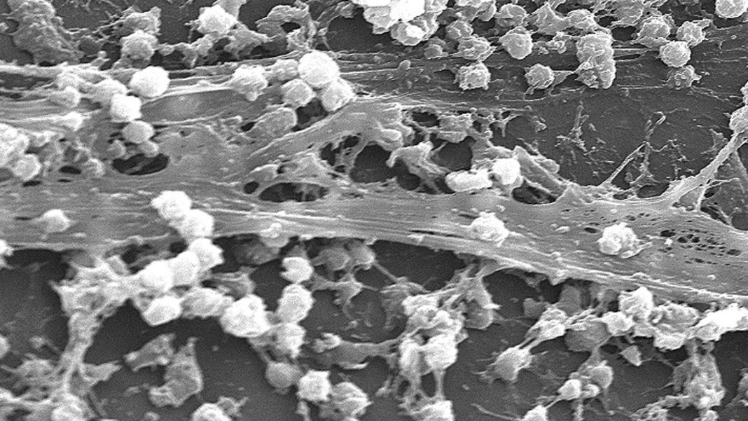Les biofilms, qu'est-ce que c'est
