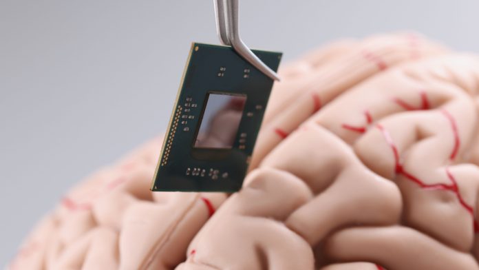 La puce cérébrale Neuralink a été implantée pour la première fois chez ...