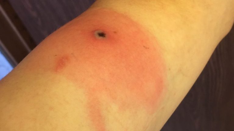 Faut-il s’inquiéter de l’Alaskapox, ce mystérieux virus qui vient de ...