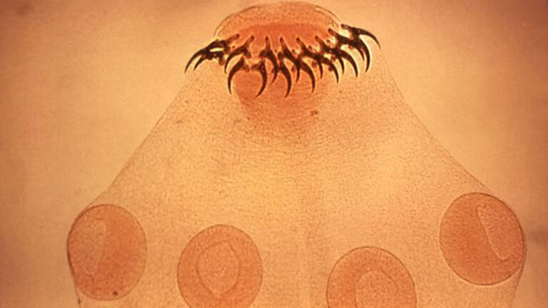 À vous retourner l’estomac : certains parasites intestinaux peuvent ...